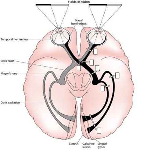 Lab 10 Diagram 7 Diagram Quizlet