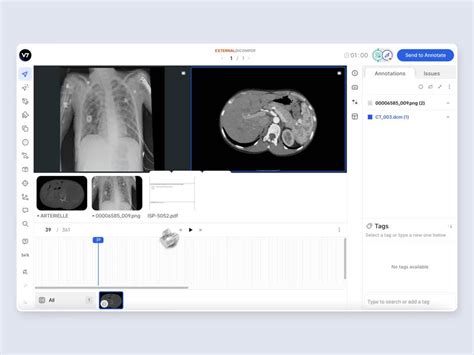 V7 On Linkedin Thanks To Our New Layouts Feature Annotating Medical