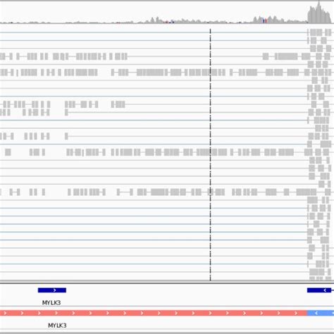 Figure S8 Igv Visualization Of Fusion Gene Tsv Involving Asxl1 And