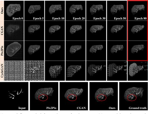 Figure 1 From End To End 3d Liver Ct Image Synthesis From Vasculature Using A Multi Task