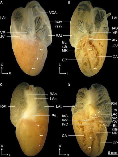 Longitudinal Views Of The Diastolic Heart From A 1500 G Specimen A Download Scientific Diagram