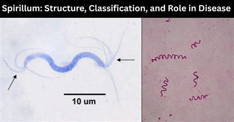 Spirillum Structure Classification And Role In Disease