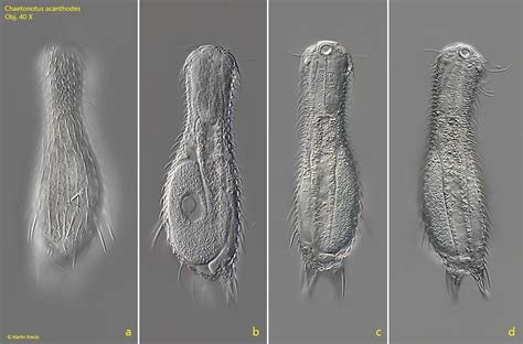Chaetonotus Acanthodes Real Micro Life