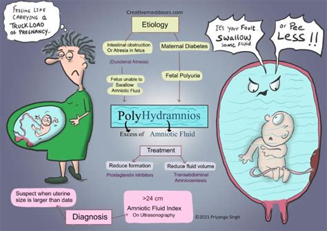 Polyhydramnios Excessive Amniotic Fluid Creative Med Doses