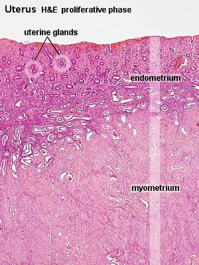 Histology Slides Database Uterus In Menstrual Phase High Resolution