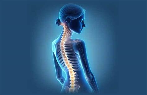 Management Of 100 Degree Scoliosis Cases Treating Scoliosis