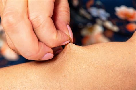 What To Do After A Tick Bite Ticks Cdc