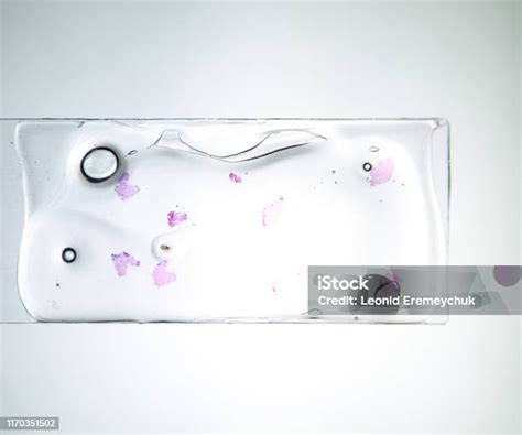 유리 아래 종양의 조각 암의 존재를 위한 종양 세포의 조직학 검사 암에 대한 스톡 사진 및 기타 이미지 암 환자 건강 진단 Istock