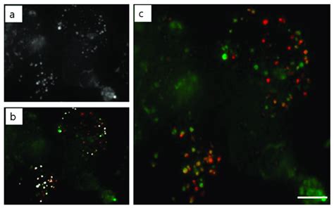 Fluorescent Microscopy Images Showing Lysosome Staining Red And