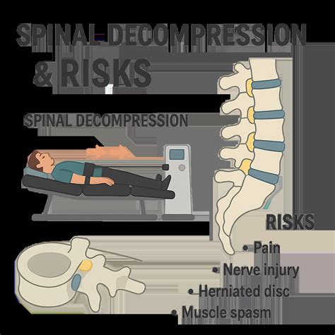 Traction Therapy For Herniated Disc