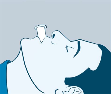 Guedel Airway Kit Oropharyngeal Airways For Emergency Care O Two