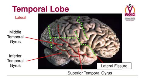 Lab 303b Ppt Download