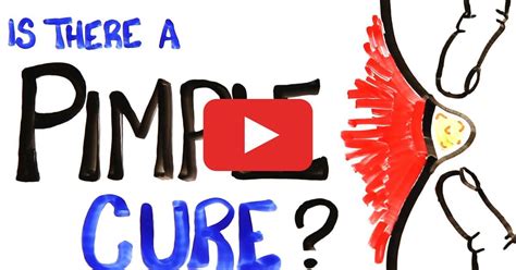 This Video Shows The Best Ways To Prevent Pimples Artofit