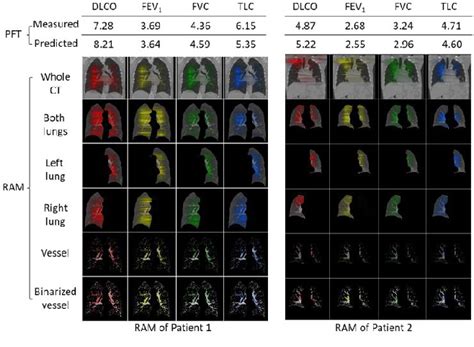 Figure 1 From Automatic Pulmonary Function Estimation From Chest Ct