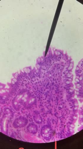 A P Lab Tissues Pics Flashcards Quizlet