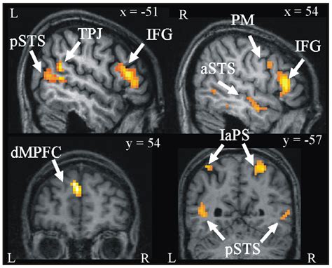 Fmri Results From Random Effects Analyses Social Interaction Non Download Scientific Diagram