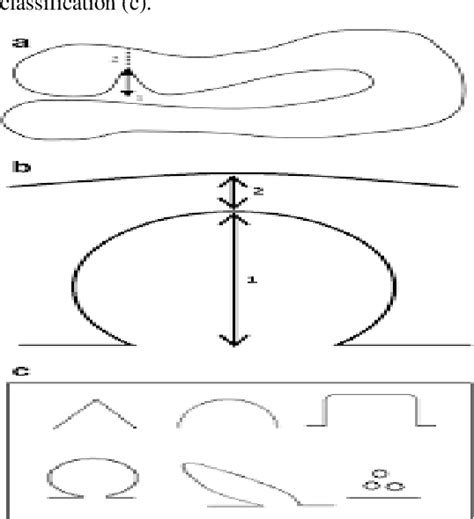 Figure 2 From Trans Vaginal Assessment Of Cesarean Scar Niche And Its Complications In Non