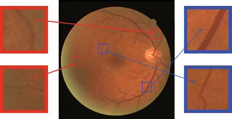 Arteries And Veins Of Different Scales In The Retinal Fundus Images Download Scientific