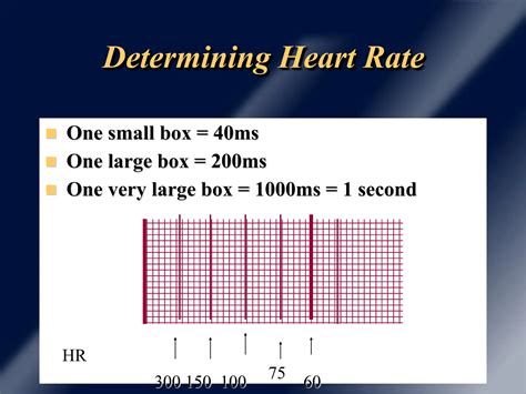Pediatric Egc Interpretation Overview Of Pediatric Ecg Pdf