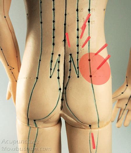 Acupuncture Points Used For Sciatica