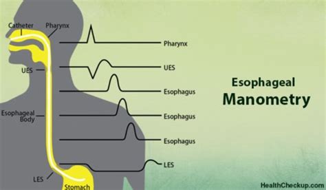 Esophageal Manometry Test Procedure And Side Effects Of Test