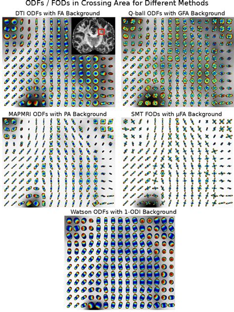 Orientation Distribution Functions Odfs For Dti Q Ball Mapmri The Download Scientific