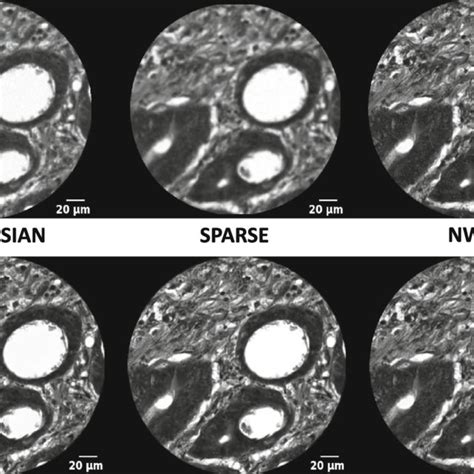 Sample Reconstructions From 6 Methods Handling Sparse Data In Different