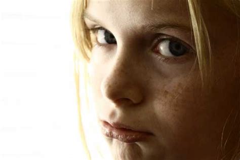 Дети дцп 7 ранних признаков 4 линии терапии