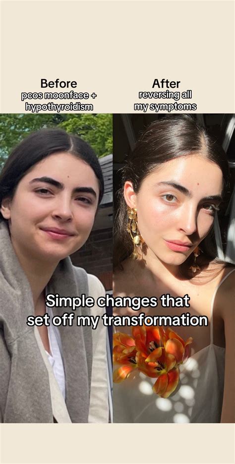 Mila Mila Magnani Tiktok In 2024 Beauty Treatments Skin Care