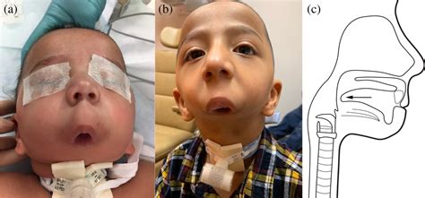 Cyclopia Survivor