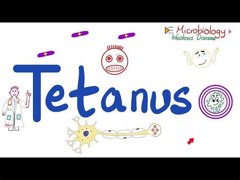 Free Video Tetanus Disease Microbiology And Infectious Diseases From