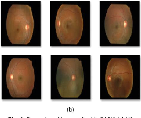 Figure 1 From Achieving Information Security By Multi Modal Iris Retina Biometric Approach Using