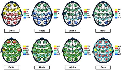 Quantitative Electroencephalography For Probing Cognitive And Behavioral Functions Of The Human