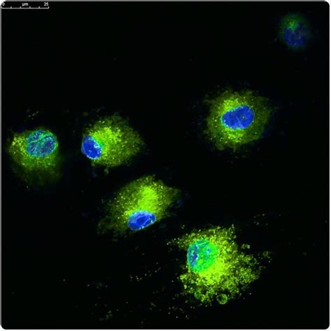 Bifc Limitations Health Worlds News