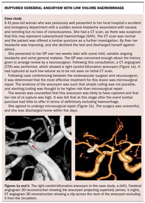 Cerebral Aneurysms And Subarachnoid Haemorrhage Avoiding The