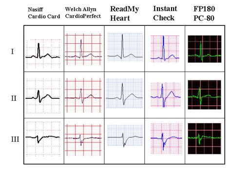 Normal 12 Lead Ecg Labeled