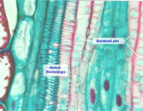 Tracheids Cross Section