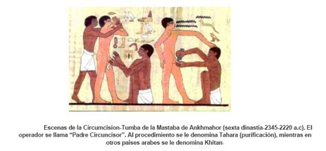 Qué Es Circuncidar En La Biblia Un Análisis Profundo De Este Ritual