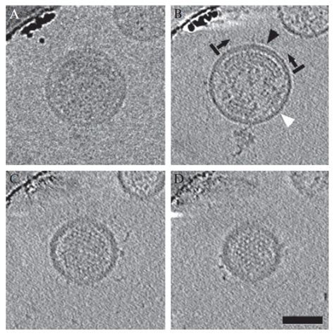 2 Raw Image And Slices Through The 3d Reconstruction Of An Hiv 1
