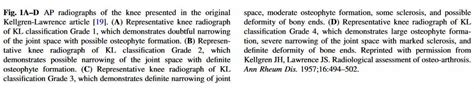 Osteoarthritis Genu Kellgren Lawrence Classification Radiologiid Osteoarthritis Genu Kellgren Lawrence Classification Radiologiid