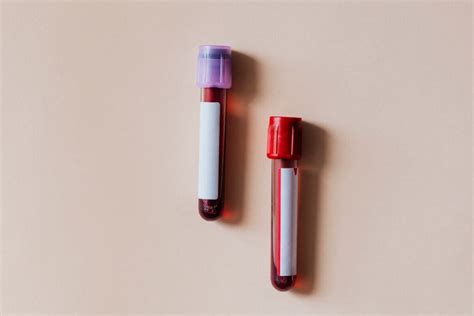 GOT GPT labor Újbuda Medical Center