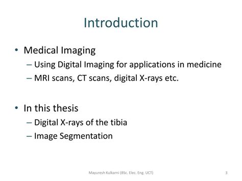Ppt X Ray Image Segmentation Using Active Shape Models Powerpoint