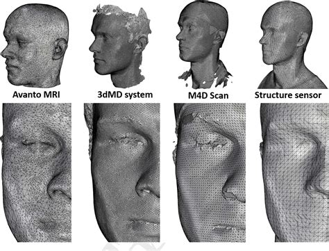 Table 1 From Comparison Of Three Dimensional Scanner Systems For Craniomaxillofacial Imaging