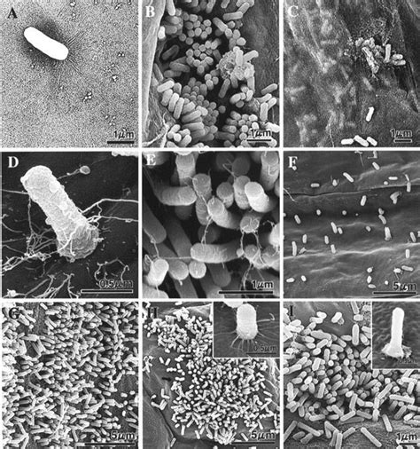 Lysobacter Alchetron The Free Social Encyclopedia