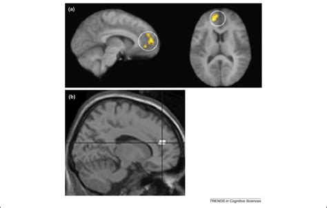 Functional Development Of MPFC In Self Tasks Activity Changes In MPFC Download Scientific