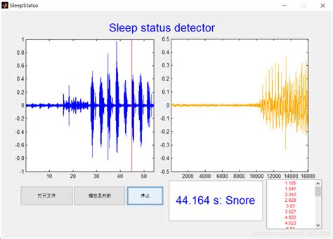 【脑电信号】基于matlab Hmm睡眠状态检测【含matlab源码 050期】 云社区 华为云