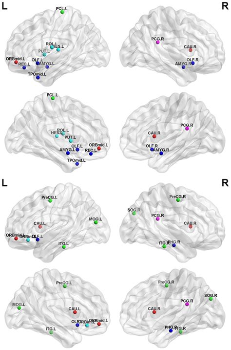Hubs Of The Functional Brain Networks In Each Group The Results Were