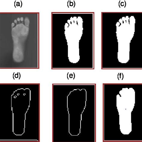 Preprocessing Steps A Input Image B Binary Image After