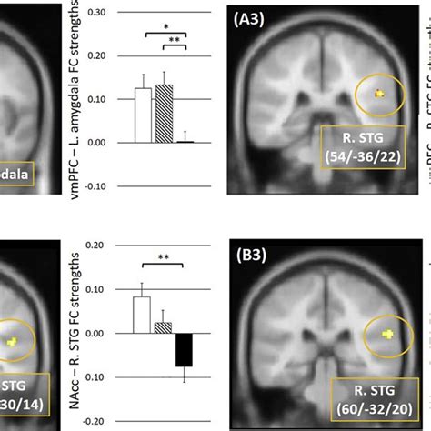 Seed Based Resting State Functional Connectivity Rsfc And The