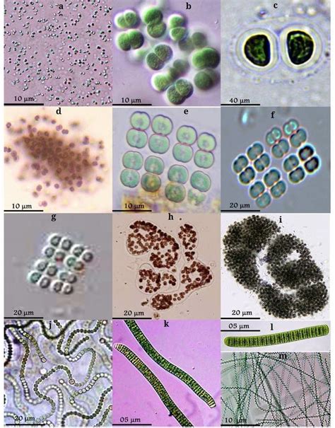 A Aphanocapsa Grevillea B Chroococcus Limneticus C Chroococcus